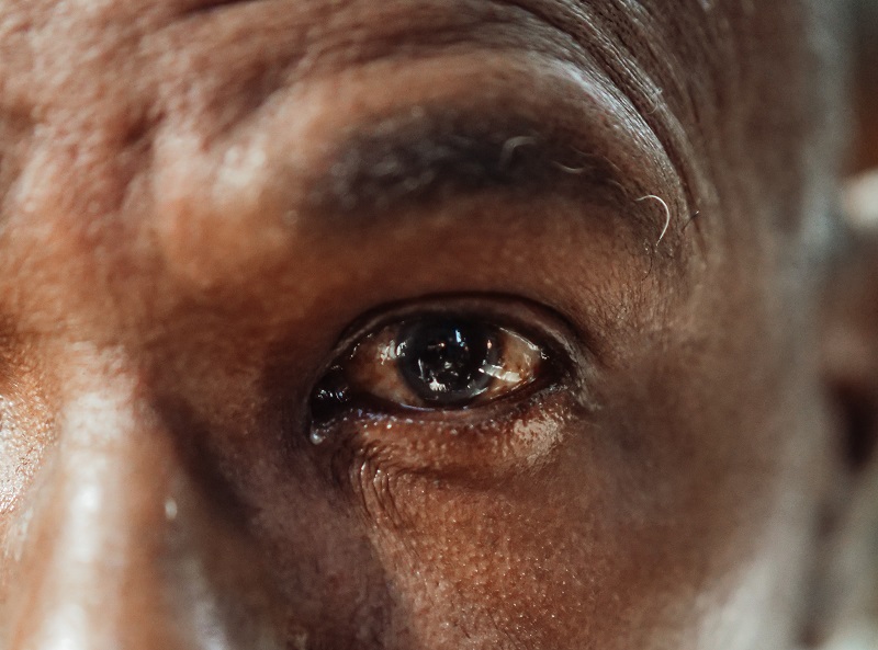 What You Should Know About Age-Related Eye Conditions | Wake Family Eye ...